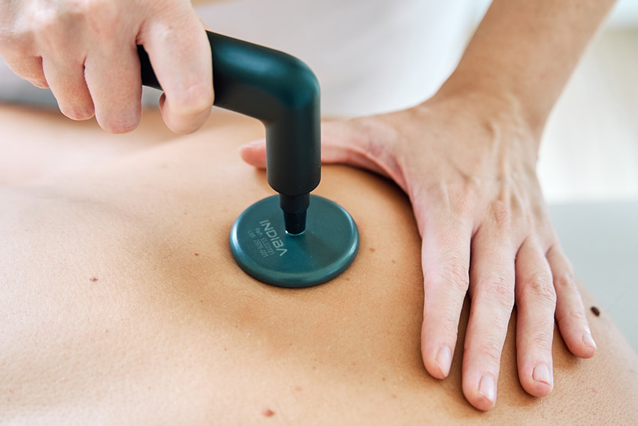 Fisioterapia INDIBA en Madrid | EstudioFisio